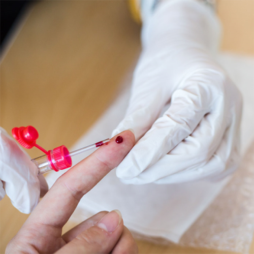 EMB Bloedwaarden test - Puur met olie